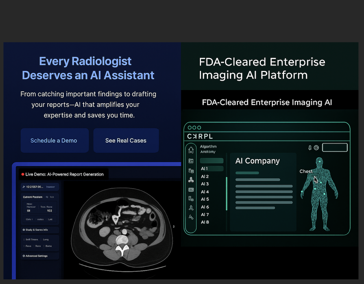 BrainX Community Live! Summer 2025: Radiology platforms for AI ...